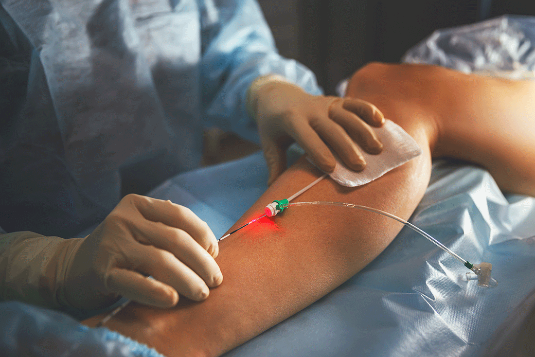 Vascular - Your Medical Services